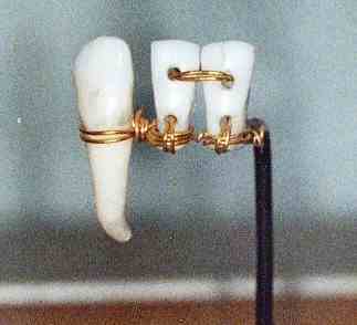 Ancient Egyptian Dentistry - DentalSave Dental Plans