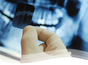 Comprehensive Oral Evaluation | DentalSave Prescription Drugs Discount ...